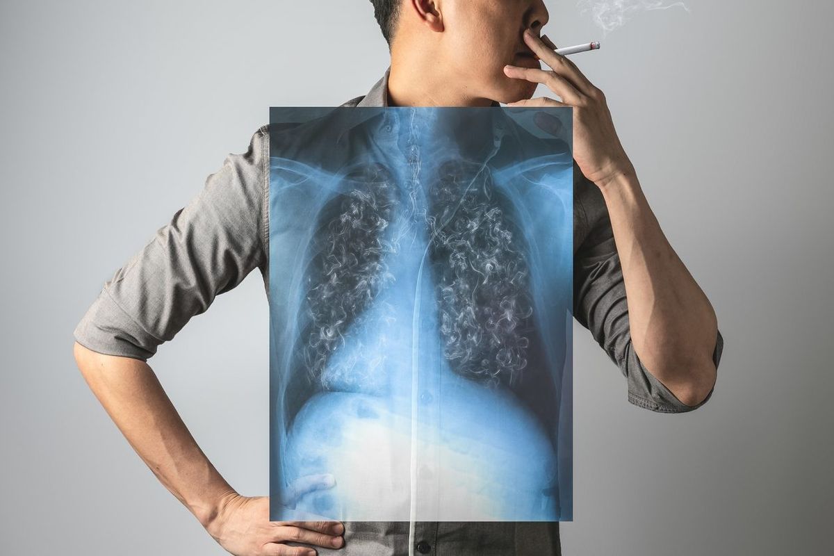 Long-term smokers show symptoms not meeting smoking-related disease ...