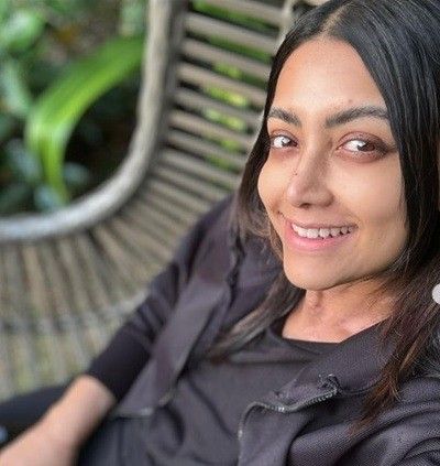 Indian actor Mamta Mohandas diagnosed with vitiligo – All you need to ...